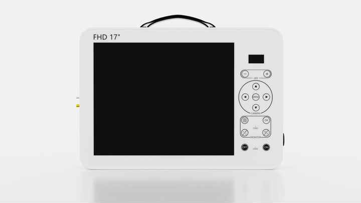 SHREK Nasal Endoscopy Cost - Portable Full HD Camera Endoscope 17"