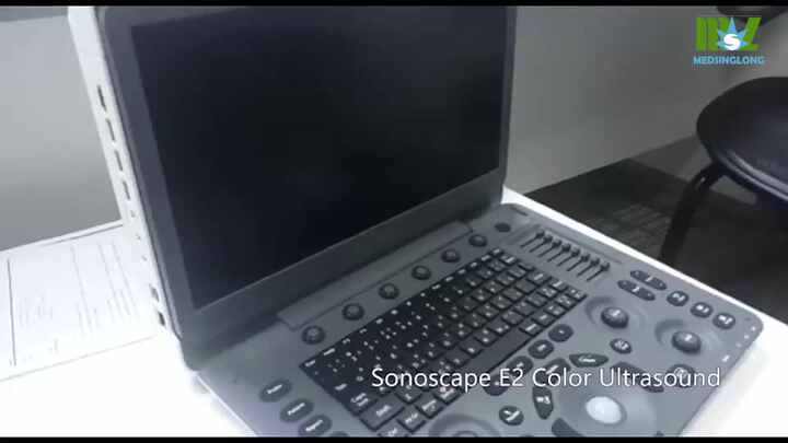 Sonoscape E2 Portable Ultrasound Machine - 3D 4D 5D MSK OB/GYN