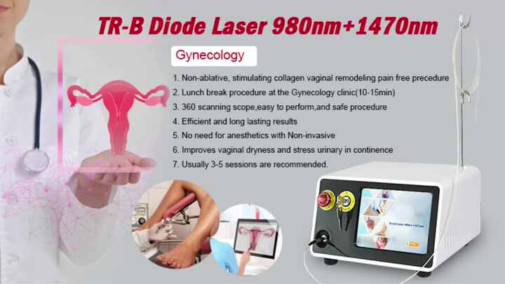 Dual Wavelength 980nm 1470nm Laser Gynecology Vaginal Tightening ...