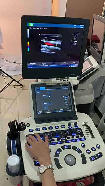 4D Ultrasound Machine for Sale - Premium Pregnancy Scanner