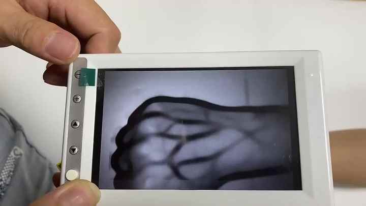 Infrared Vein Scanner - Portable and Accurate Vascular Imaging