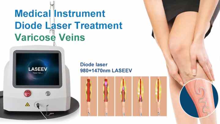 EVLT/EVLA Endovenous Laser Ablation Varicose Veins Diode Laser ...
