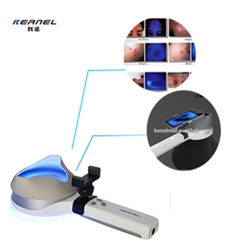Wood's Lamp, Wood's Lamp direct from Kernel Medical Equipment Co., Ltd ...