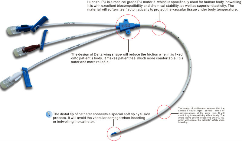 Triple Lumen Catheter Proximal Medial And Distal