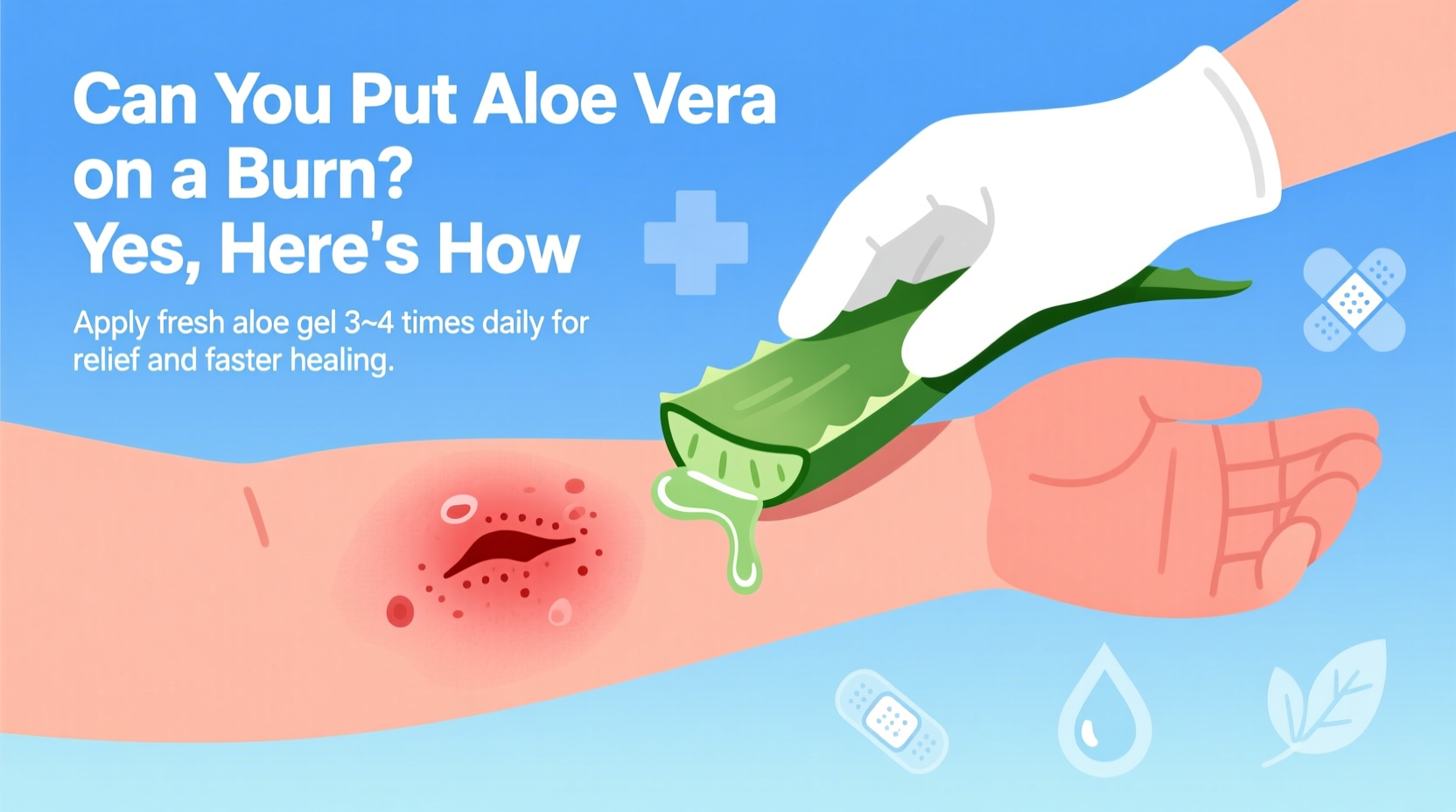 Can You Put Aloe Vera on a Burn? Yes, Here's How