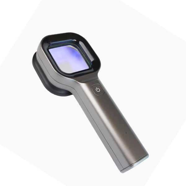 SY-W01 Wood's Lamp - Detect Bacterial & Fungal Infections