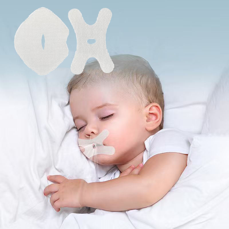 Custom Lip Shape Breath Tape Mouth Improves Sleep Mouth Tape X Shape ...
