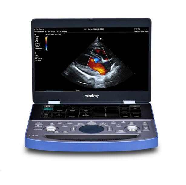 Mindray Vetus E7 Portable Ultrasound Imaging System for Veterinary Use ...