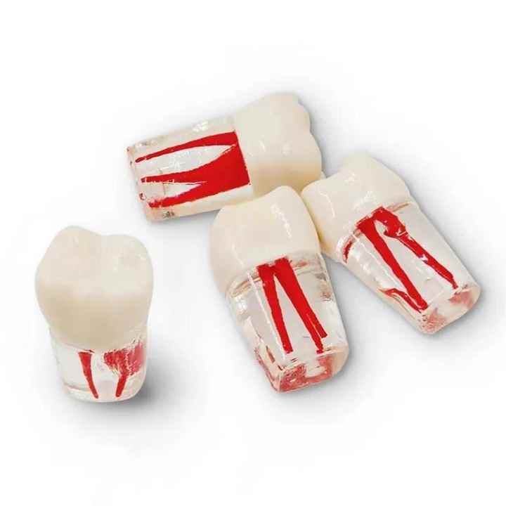 5PCS 1:1 Resin Dental Endodontic Tooth Model Endo Root Files Pulp ...