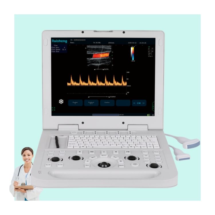 Portable Color Doppler Ultrasound Machine for Veterinary and Medical ...