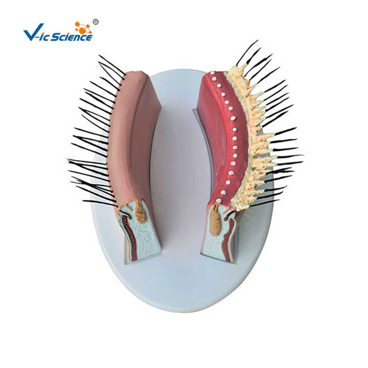 Blepharitis Model - Detailed Human Eye Anatomy for Teaching