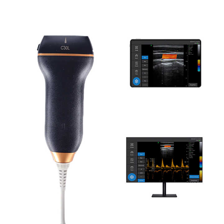 Abdominal Echocardiography Handheld Ultrasound Probe Portable Wireless ...