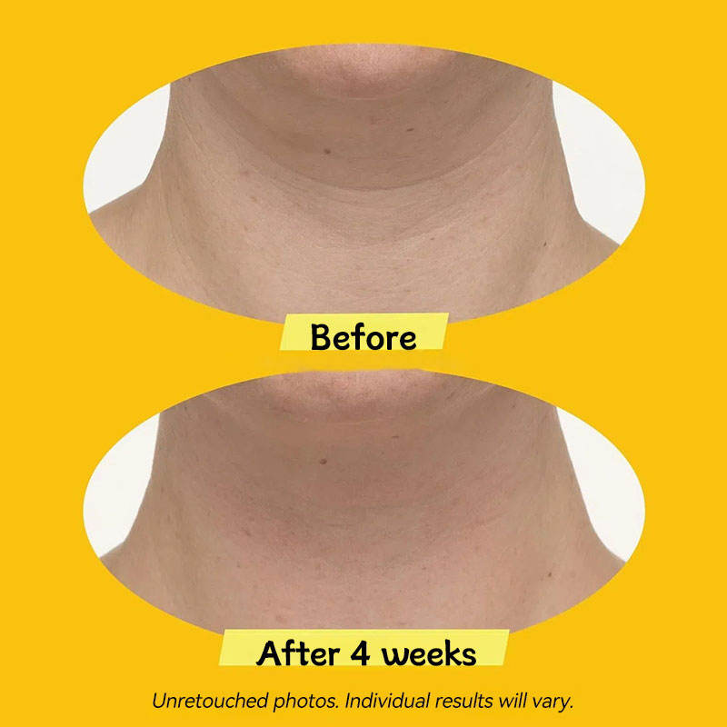 OEM Best Sensitive Skin Collagen Organic Vegan Neck Firming Cream Anti ...