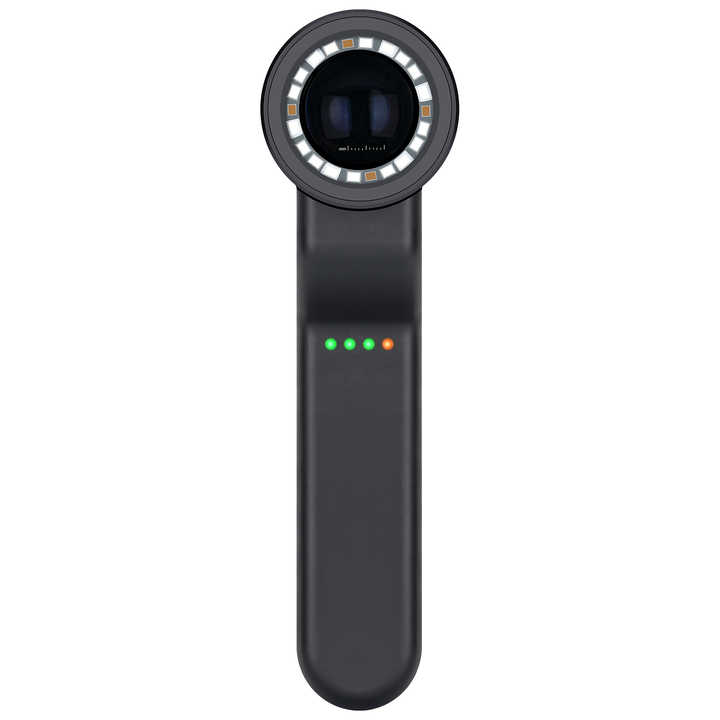 10x Medical High Definition Handheld Dermoscope for Diagnosis of Skin ...