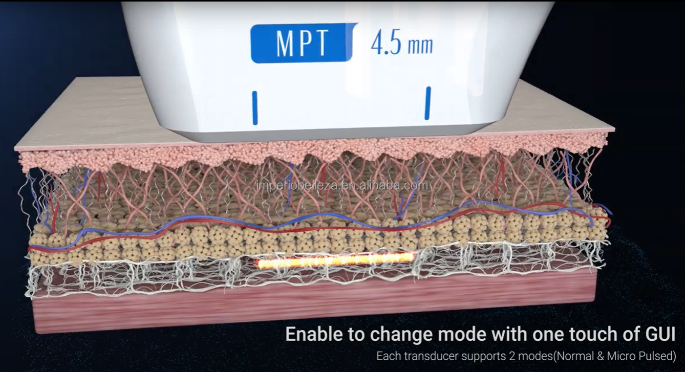 Latest HIFU Technology Ultraformer MPT MMFU 7D Ultraformer IV Face and ...