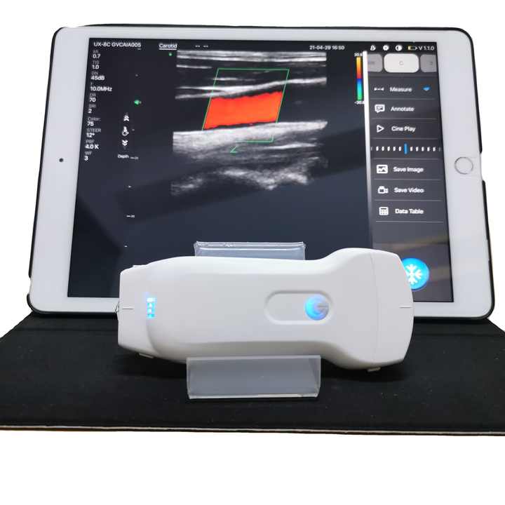 MSLPU80 Double Probes Wireless Color Doppler Ultrasound Scanner