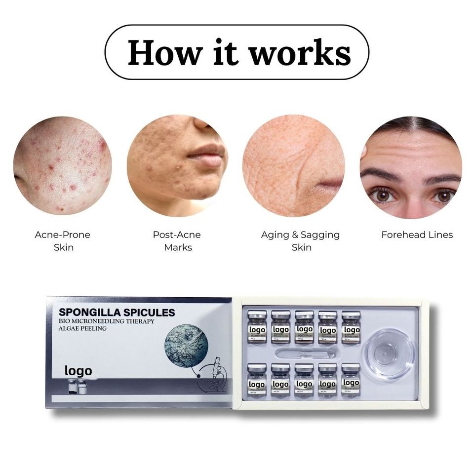 Customization Bio Peel Refreshed Skin Spongilla Spicules Bio ...