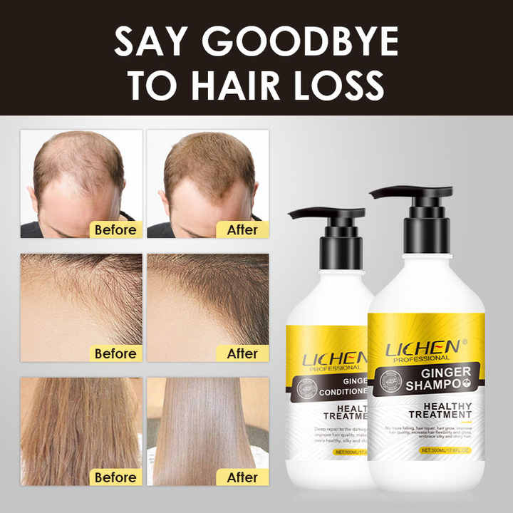 Fast Hair Growth Shampoo and Conditioner - Best Sellers