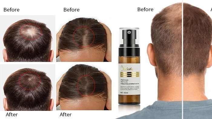 Natural Hair Growth Serum - Vegan Regrowth & Treatment