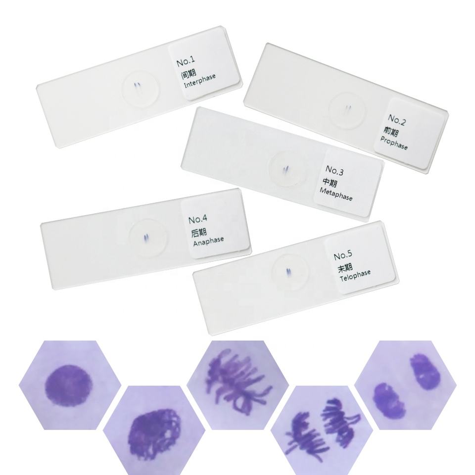 Onion Root Tip Mitosis Slides for Plant Cell Study - Clear Specimens ...