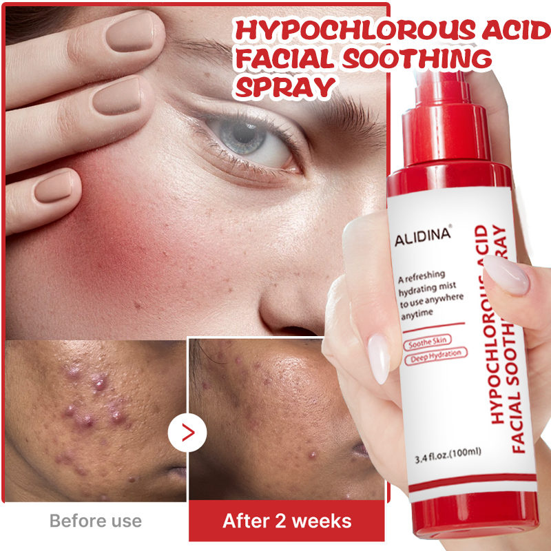 R Hypochlorous Acid Power Soothing Spray Delicate Skin Daily Solution ...