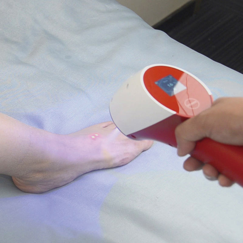 Powerful CO2 Portable Shock Cryo Therapy Device for Fast Pain Relief