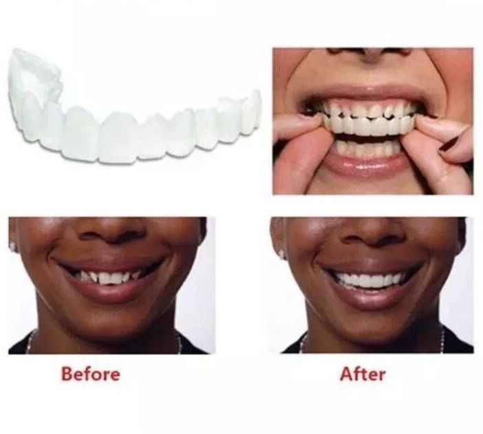 Upper And Lower Teeth Accessories Cover Silicone Artificial Teeth ...