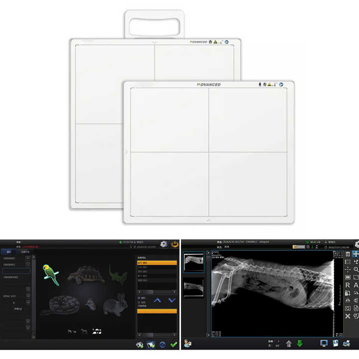 MSL Flat Panel Detector - Fluoroscopy X Ray with Battery
