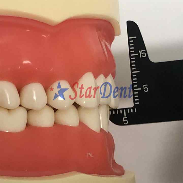 Measure Dental Ruler Accurately Metal Dental Precision Measuring Ruler ...