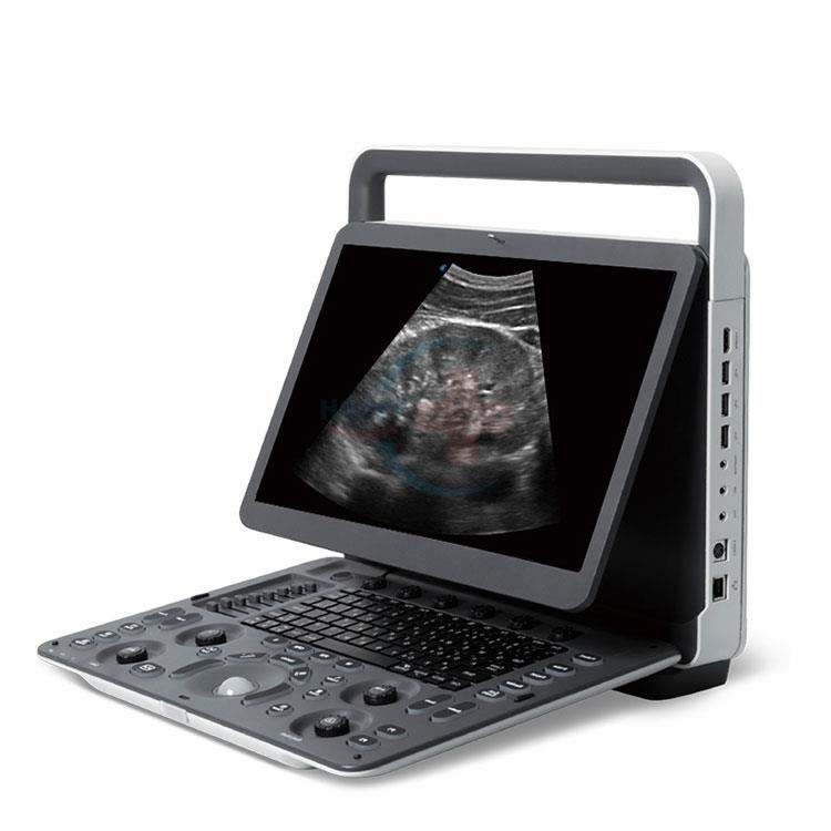 Sonoscape E2V Ultrasound Machine - Portable Veterinary Ultrasound