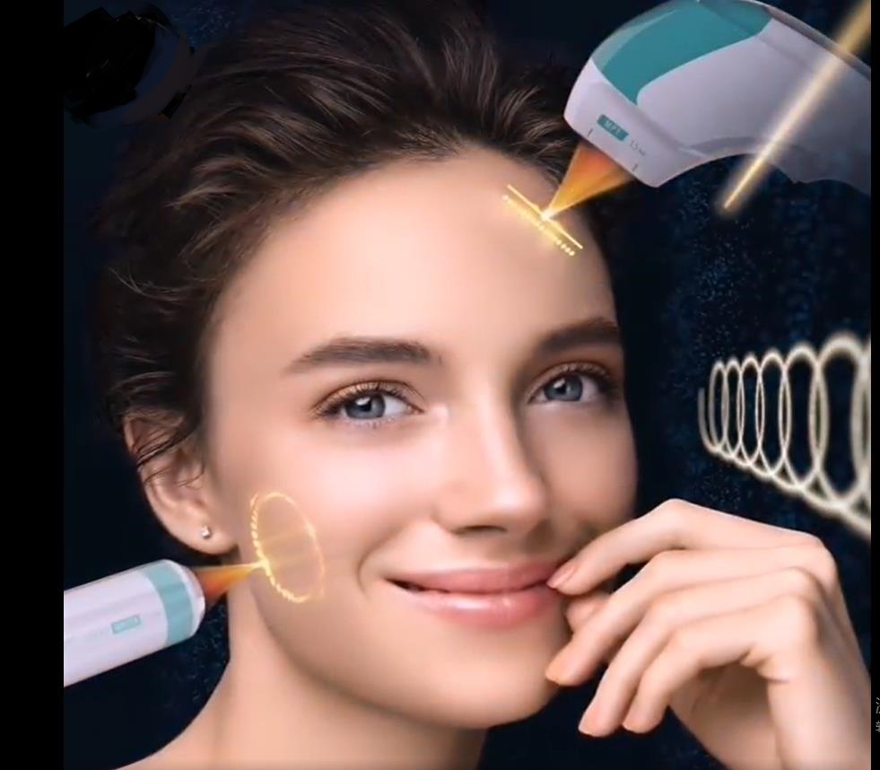 Latest HIFU Technology Ultraformer MPT MMFU 7D Ultraformer IV Face and ...