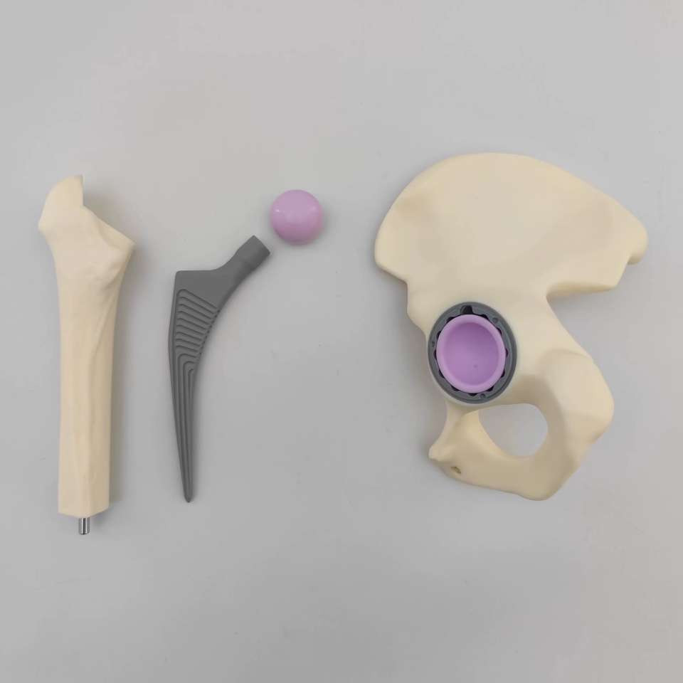 KyrenMed Mini Hip Replacement Model Hip Implant Model Orthopedic ...