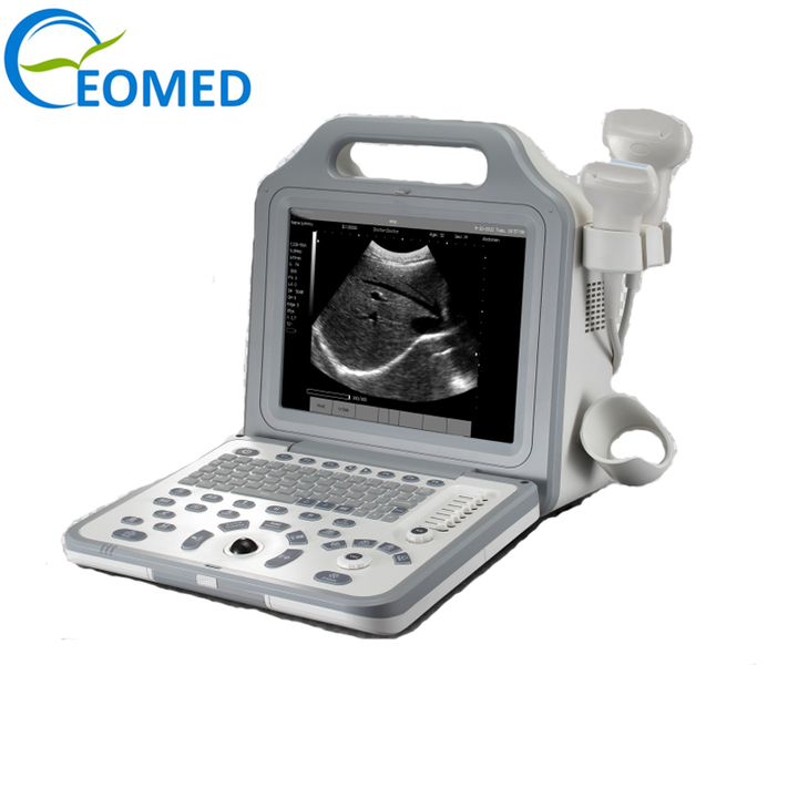 Hospital Human OB&GYN B/W Diagnostic Ultrasound System Machine ...