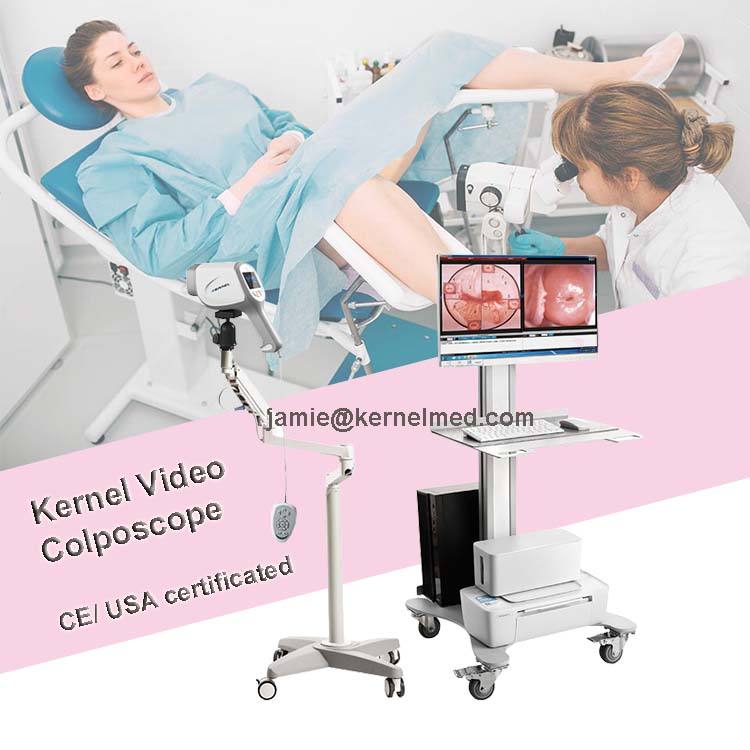 CE Medical Endoscope Colposcopia Optical Binocular Portable Colposcope ...