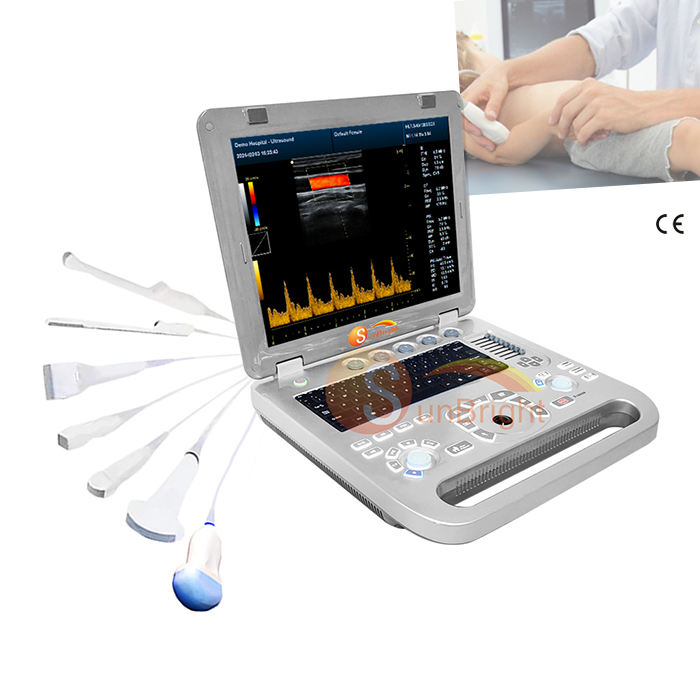 15 inch professional cardiac color doppler TDI ultrasound Hospital ...
