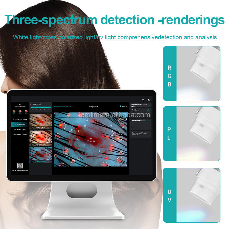 Professional 15.6 Inch HD Screen Scalp Scanner Detector