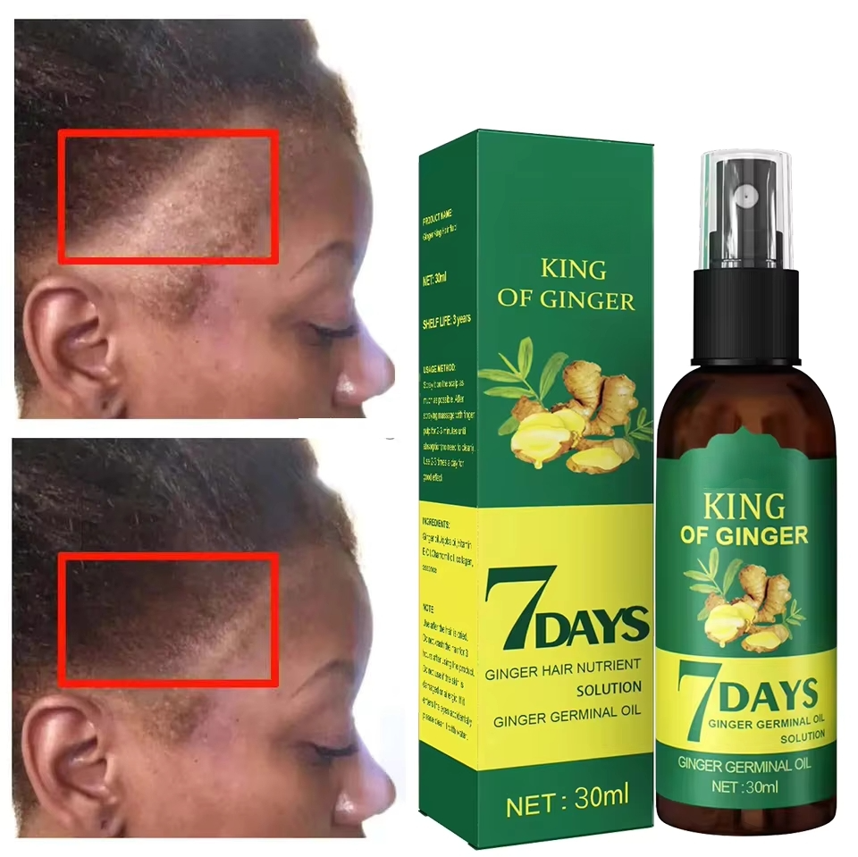 Green Ginger Anti-Hair Prevent Loss Oil,Ginger 7 Days Hair Growth ...