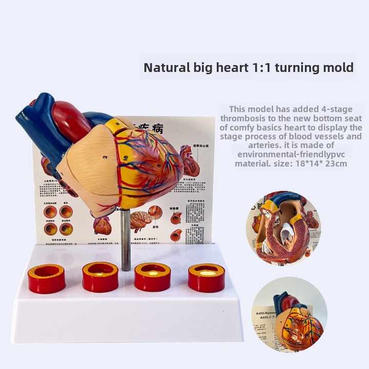 Detachable PVC Heart Anatomy Model Human Standard for Medical Science ...
