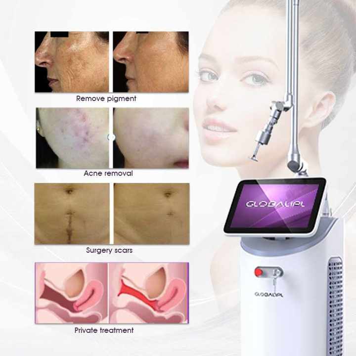 Professional Custom Cheap Good Price Ce Co2 Fractional Laser