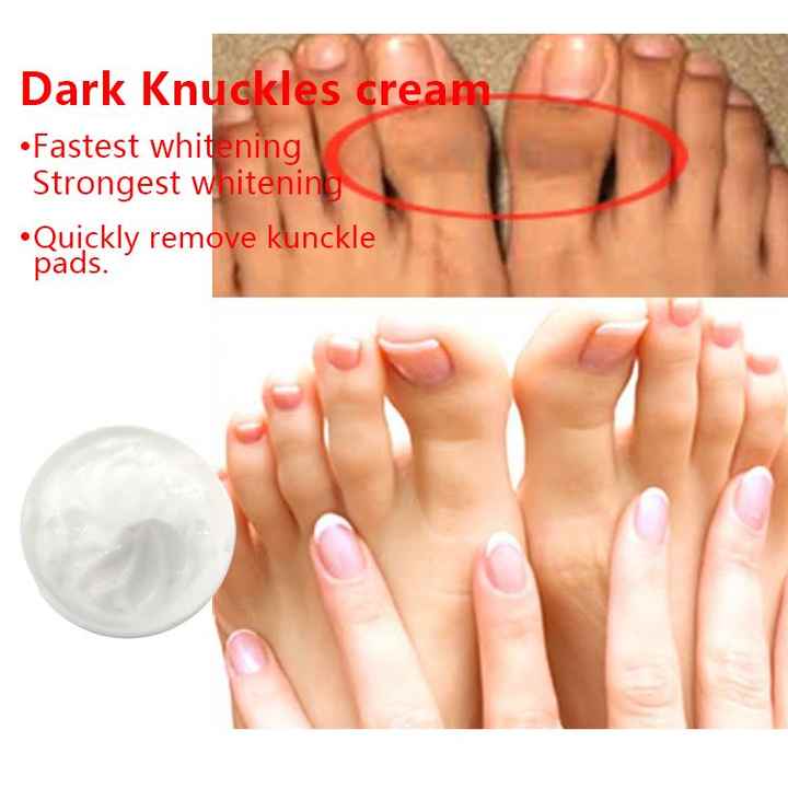For Dark Knuckle Whitening Dead Skin Remover Strong Green Peeling Oil ...