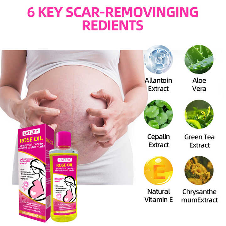 Custom Labels Remove Scar and Stretch Marks Oil Powerful and Effective ...