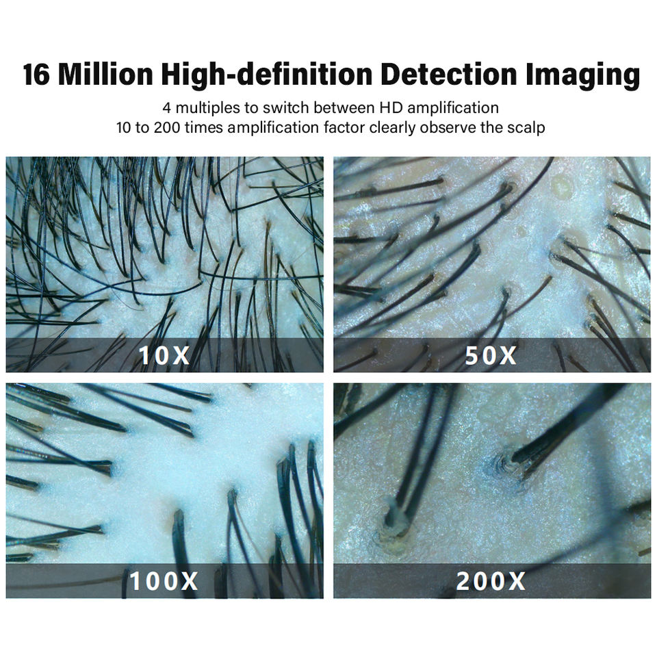 New Trend 2025 Printing Report AI Scalp Analysis Machine Hair Analyzer ...