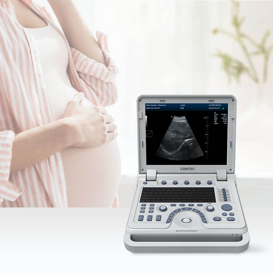 CONTEC CMS1700B Echocardiogram - Portable Ultrasound System