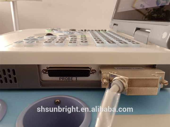 Ultrasound Machine Abdominal Cardiac Portable USG Clinic Hot Selling