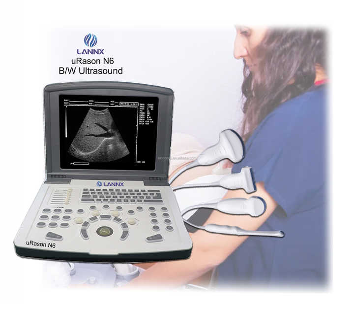 LANNX Urason N6 Customization Cardiac OB GYN Ultrasound Scanner