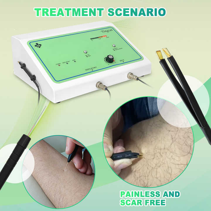 Esthetic Body Face 2in1 Mole Removal Pen Needle*6pcs Epilator Insulated ...
