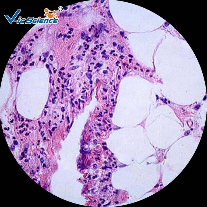 Microscope Slide of Pathology Disease Educational Slides