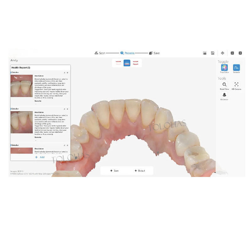 LHMV3P Medical Dental Equipment Real-time Review 3D True Color ...