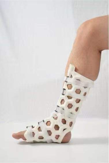 Orthopedic Liquid Exoskeleton Brace Waterproof Support for Fracture ...