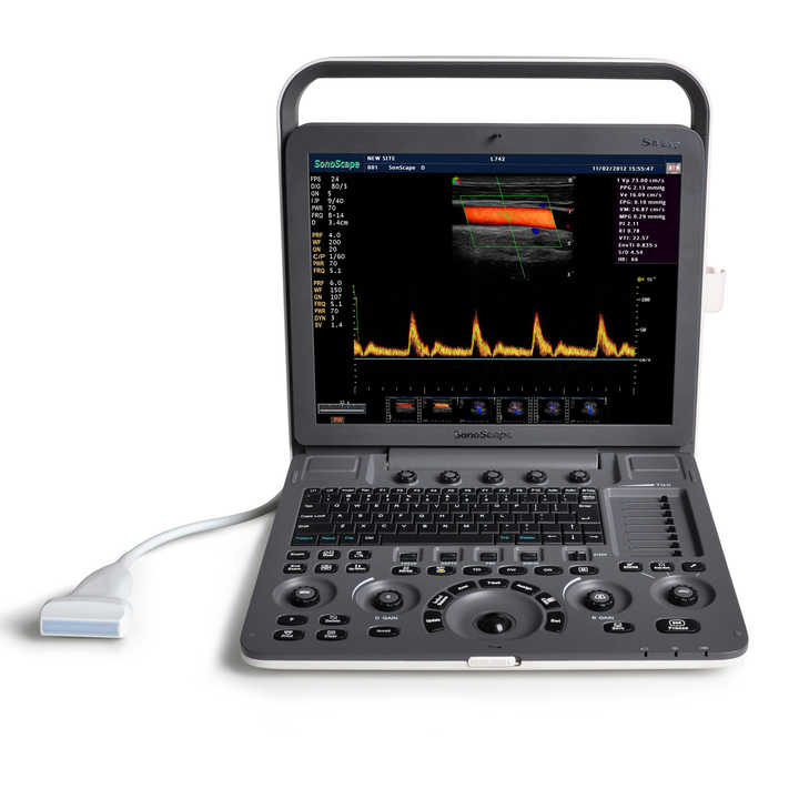 SONOSCAPE S8 Portable Echocardiogram Machine - MPTEE Transducer Doppler ...